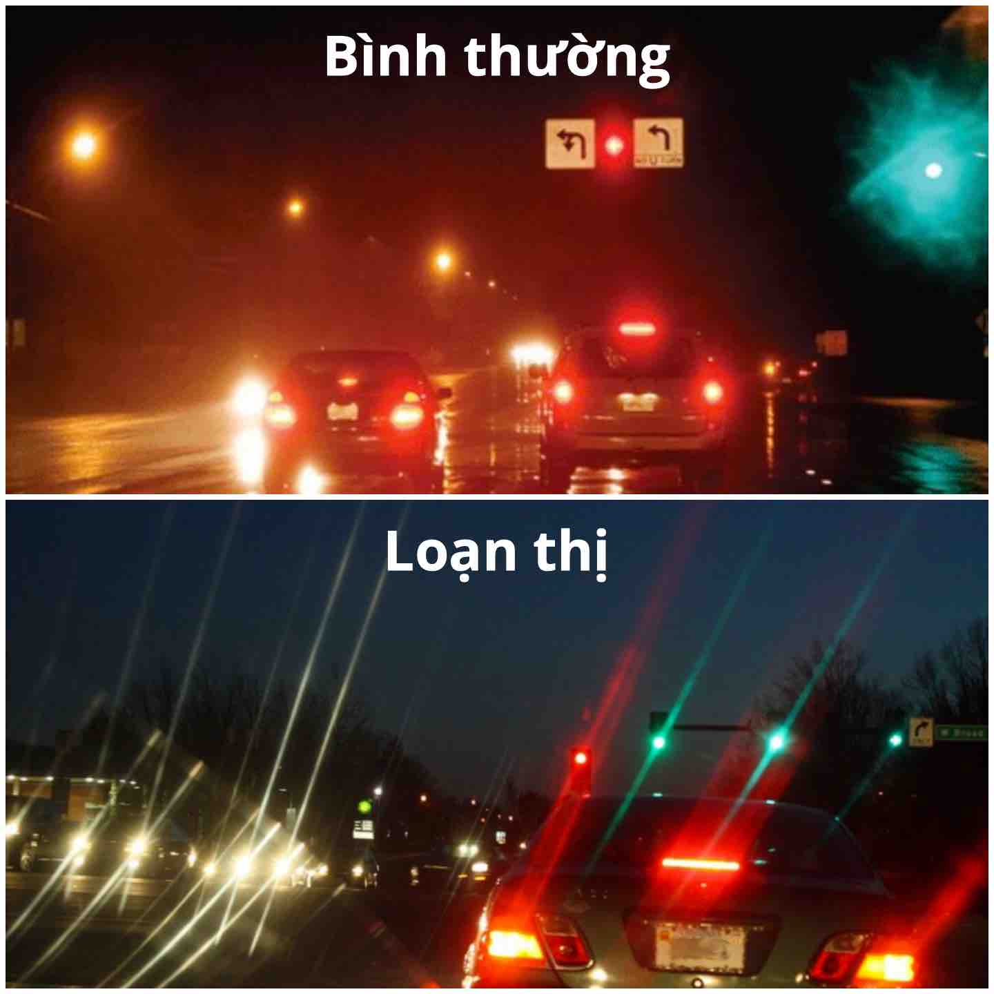 Loạn thị và các triệu chứng thường gặp 2023